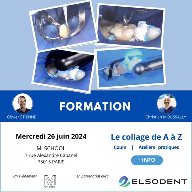 Formation Le Collage de A à Z - Elsodent