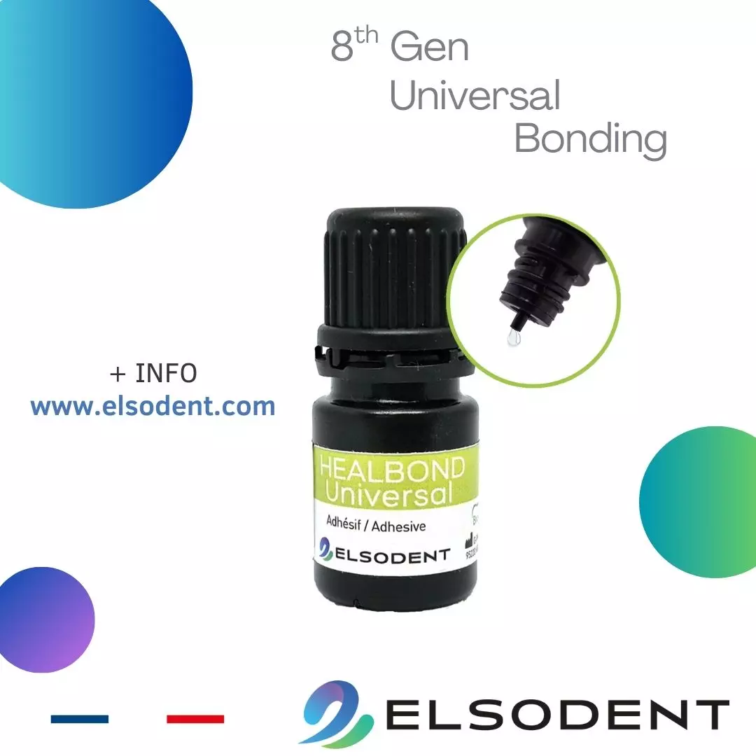 🦷 8th generation Universal Bonding: why take the plunge? - Elsodent